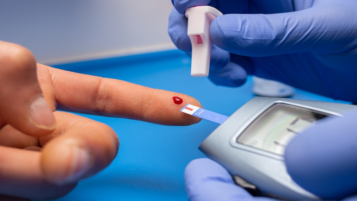 Can Liposuction help Diabetes? Get the Truth in 2024